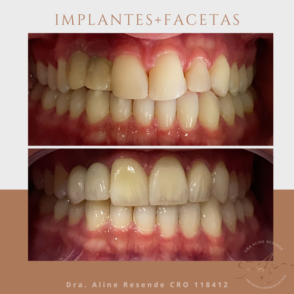Como Conquistar um Sorriso Perfeito - Clínica Aline Resende